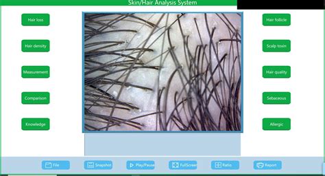 Pc Connection Scalp Forllicle Analyzer Giving Report And Recommend Portable Usb Hair Analysis