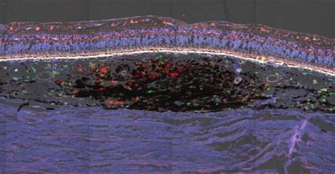 Ocular Pathology Research Group