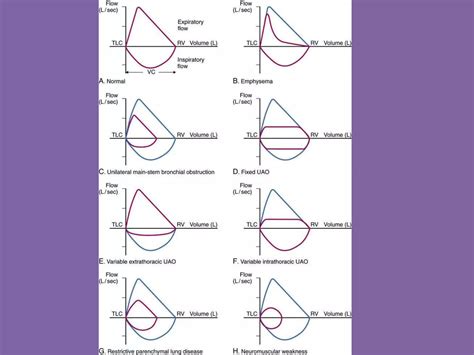 Pulmonary Flow Volume Loops Drpadmesh Pptx Lung And Respiratory