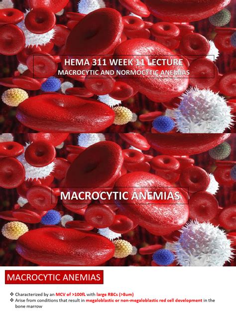 Macrocytic And Normocytic Anemias Pdf Anemia Vitamin B12