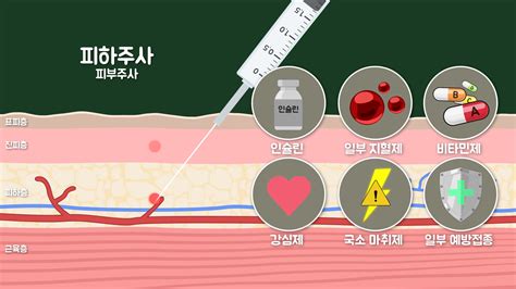 엉덩이 주사와 팔뚝 주사는 뭐가 다른 걸까