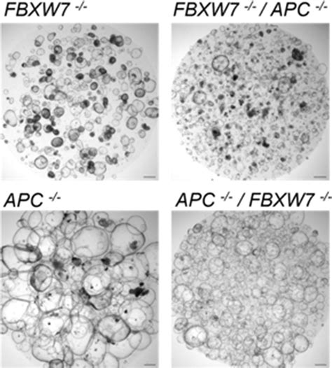 Iddf2024 Abs 0085 Mutational Order And Epistasis Regulate The Transcriptional Consequences Of