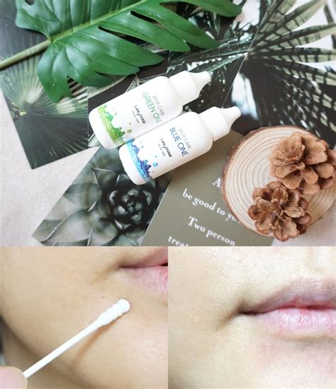 화농성여드름관리 얼굴피지제거 이지함 블루원 네이버 블로그