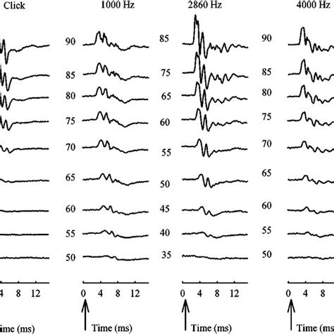 Schematic Showing How Latency And Amplitude Measurements Were Taken For