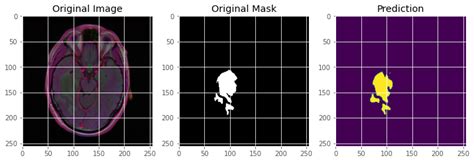 Github Mohammadbehzadpourbrain Mri Segmentation Using Unet 2d Keras
