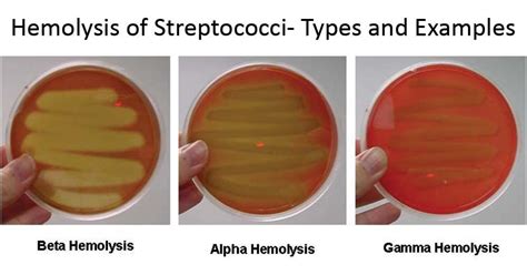 Hemolysis Of Streptococci Types And Examples Medical Technology Medical Laboratory Science