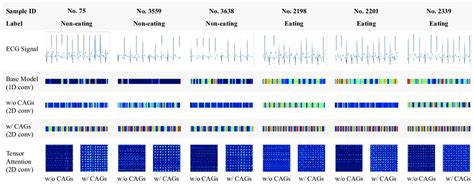 examples of saliency maps generated by the base model using the ecg