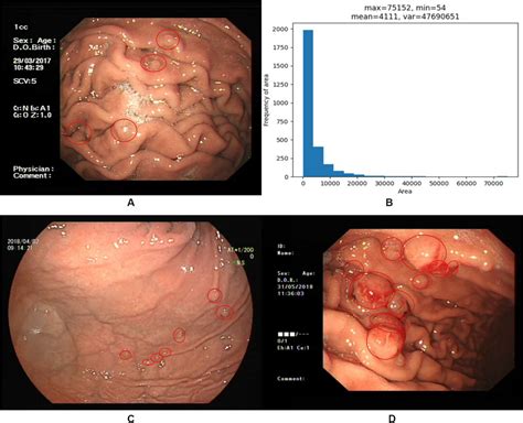 The Gastric Polyp About Our Dataset Download Scientific Diagram