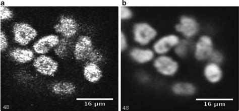 A Single Slice Before And After Denoising A Original Slice From The