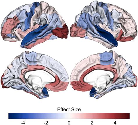 Clinical Mri Morphological Analysis Of Functional Seizures Compared To Seizure Naïve And