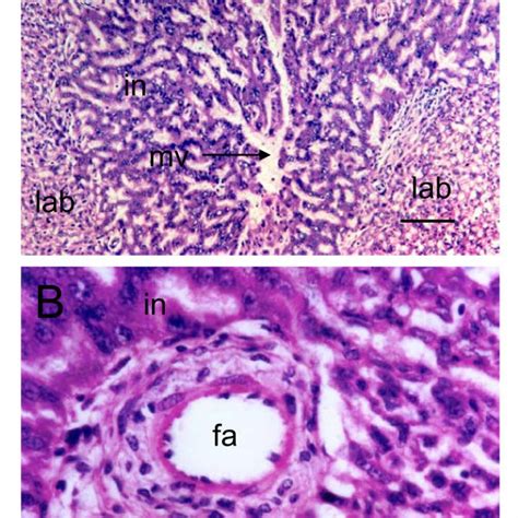 Subplacenta Junctional Zone And Pedicle Of The Paca Placenta A