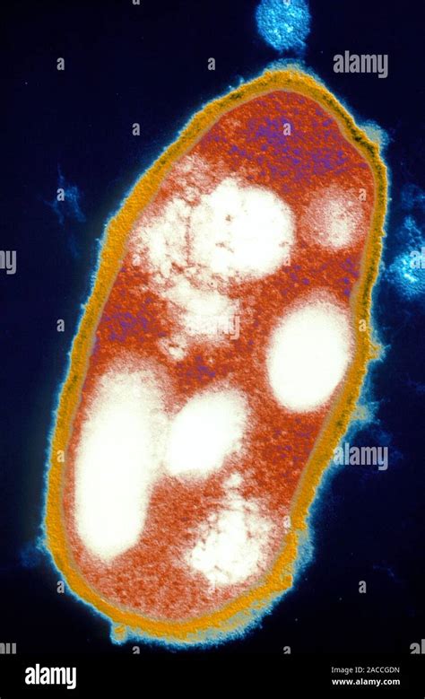 Haloferax Mediteranei Archaeon Coloured Transmission Electron