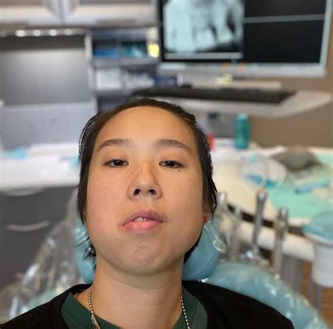 My Embarrassing Tooth Infection Eat Grow Glo