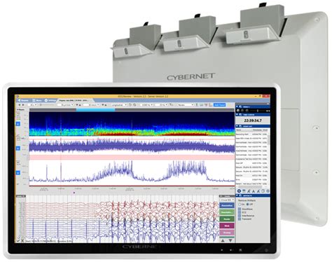 Stratuseeg Icu Nicu Cephalon Eu