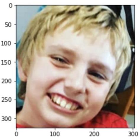 Figure 3 From Autism Spectrum Disorder Detection Using Facial Images