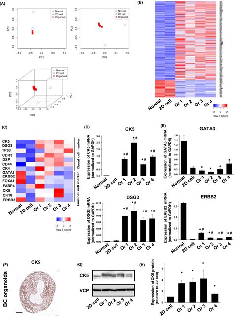Rna Sequencing Analysis Of Bc Organoids A Pca Plot Of Normal Bladder Download Scientific