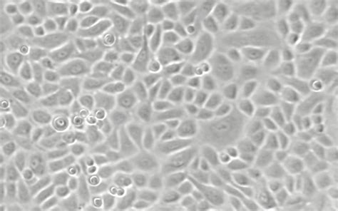 Cell Isolation And Cell Phenotyping Non Artificial Human In Vitro Skin