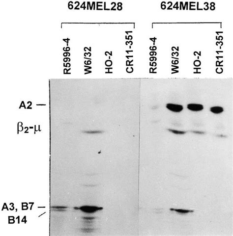 Lack Of Hla A2 Heavy Chain Synthesis By 624mel28 Cells 624mel28 And