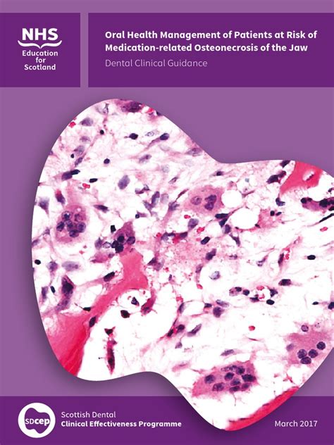 Sdcep Oral Health Management Of Patients At Risk Of Mronj Guidance Full Download Free Pdf