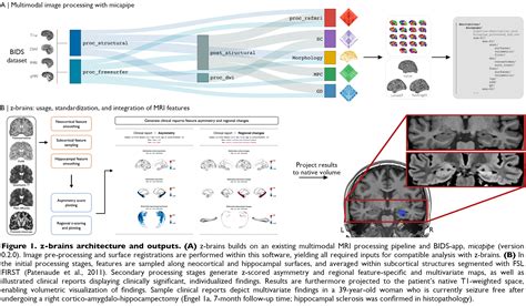 Open Access Processing And Analysis Tools For Personalized Lesion Mapping In Focal Epilepsy