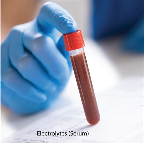 Electrolytes Serum Essa Laboratory Essalaboratory