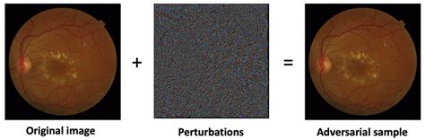 Adversarial Samples Of Messidor Dataset Download Scientific Diagram