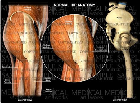 Normal Hip Anatomy Lateral View Medical Art Works
