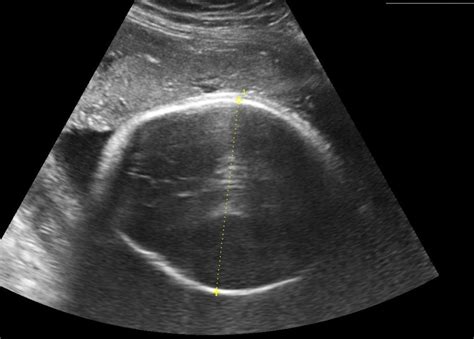 Different Types Of Ultrasounds A Comprehensive Guide Mascot Healthcare Sonoproject