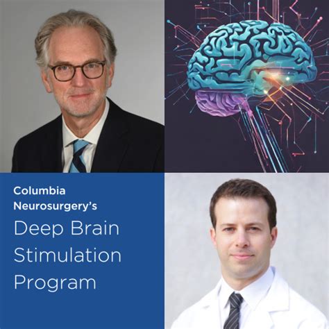 Offering Asleep Single Stage Deep Brain Stimulation Dbs Columbia