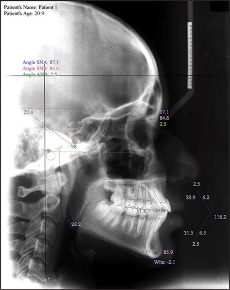 An Evaluation Of The Reproducibility Of Landmark Identification In