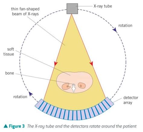OCR Physics Module Particles And Medical Physics Flashcards Quizlet