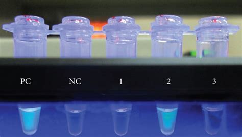 Visual Detection Of Lamp Products Under Uv Light The Combination Of