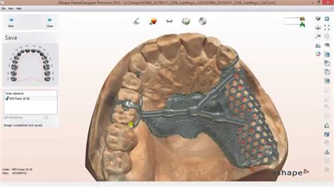 Rpd Pre Manufacturing And Finalizing In 3shape Dental System 2015 Youtube