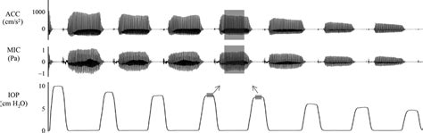 example waveforms of simultaneously recorded signals of a neck surface