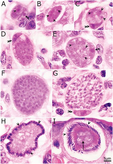 New Observations Allowing The Differentiation Of Late Asexual Stages Of