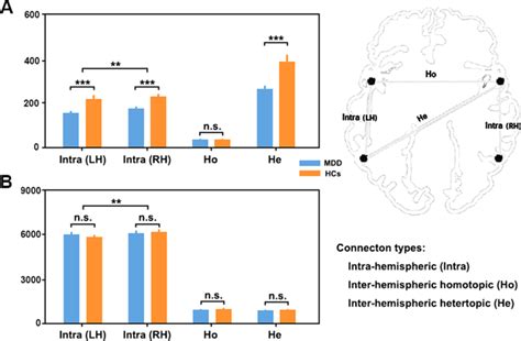 主要抑郁症患者的功能和结构性半球脑网络的connectome分析。translational Psychiatry X Mol 主要抑郁症患者的功能和结构性半球脑网络的connectome分析。translational Psychiatry X Mol