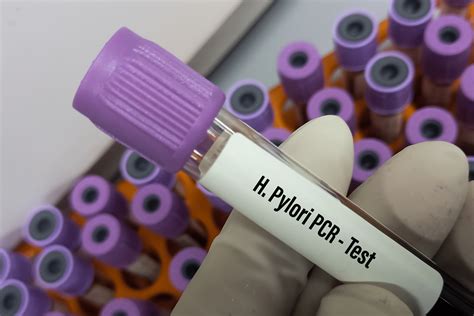 Unraveling The Impact Of H Pylori Infection On Gut Health