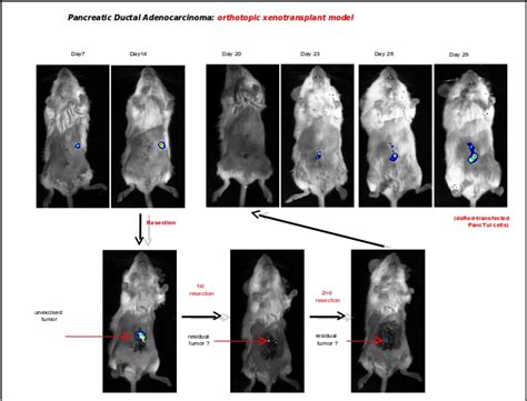 9 Impact Of Inflammation On Transport Proteins In Pdac