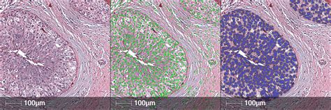 2021 Masterclass Deep Dive Into Ai Based Nuclear Segmentation And Phenotyping Part Ii Indica Labs