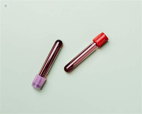 Immunoglobulin E Analysis What It Is Symptoms And Treatment Top Doctors