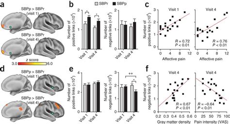 functional connectivity of nac and insula a whole brain voxelwise download scientific