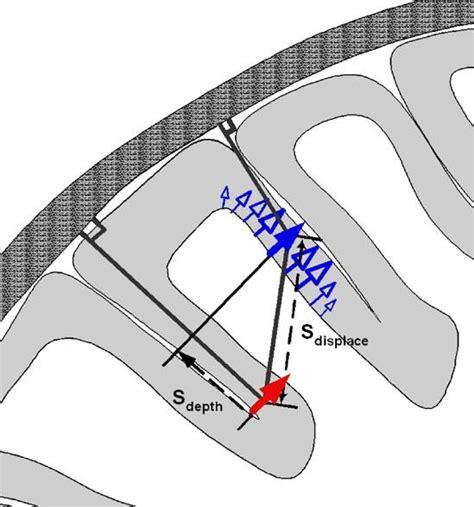 The Definition Of Metrics For Quantifying Mis Localization In The Download Scientific Diagram