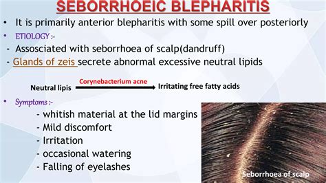 Blepharitis Pptx