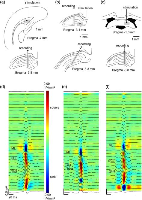 Hippocampal Responses To Electrical Stimulation Of The Major Input