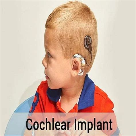 Digital Cochlear Implant Device Behind The Ear Model Namenumber Kanso 2 Sound Processor At