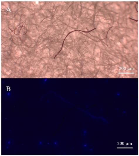 Microplastics Contamination In Nonalcoholic Beverages From The Italian