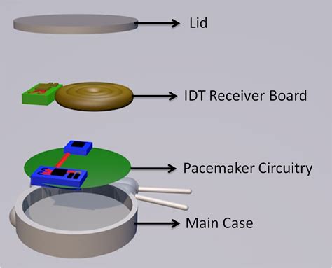 The Essential Guide To Pacemaker Pcb Materials Choosing Biocompatible And High Reliability