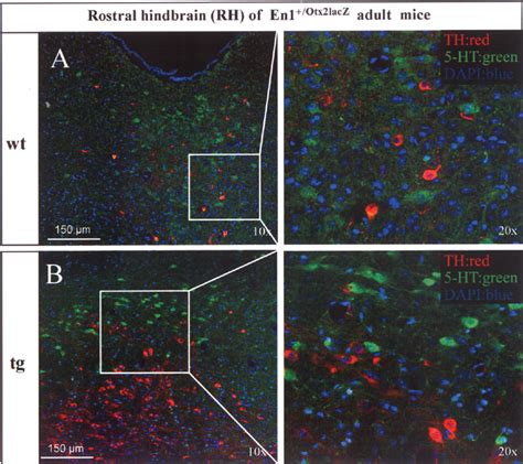 Th Red And 5 Ht Green Expression In The Rh Region In Adult