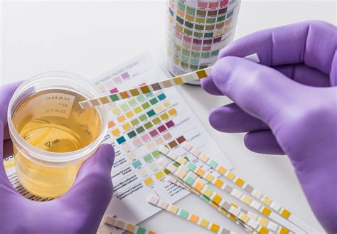 List Of Clia Waived Tests 2025 Wallace J Dillard