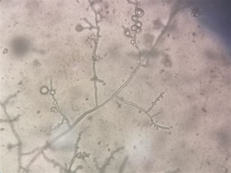 Phytophthora Management Corangamite Catchment Management Authority